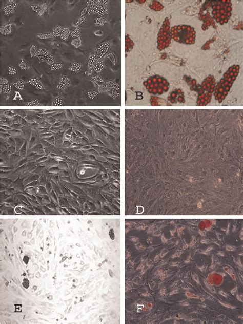 Adipogenic Differentiation Of Msc In Age Matched Controls A