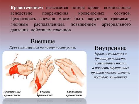 Кровотечение Первая помощь при кровотечении Online Presentation