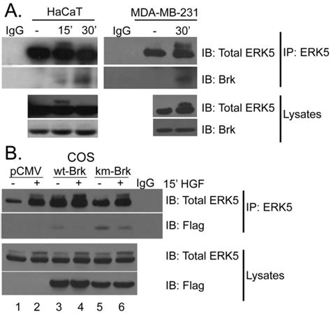 Hgf Induced Cell Migration Requires Brkerk5 Complexes In Breast Cancer