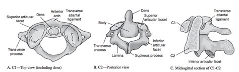 Unstable C Spine Fractures
