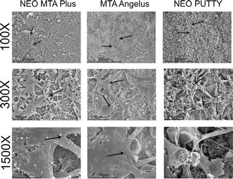 Sem Analysis Sem Images Show Cell Attachment On Neomta Plus Mta