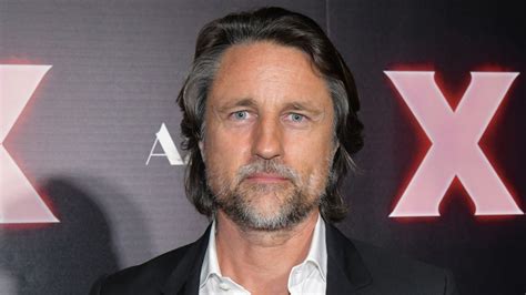 Virgin River Star Martin Henderson Posts Up Close Look At Treatment For