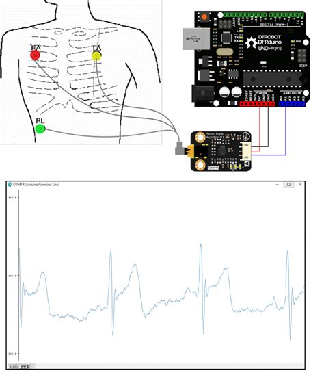 Cảm Biến Nhịp Tim Dfrobot Gravity Analog Ecg Heart Rate Sensor