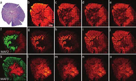 H E Image Of A Consecutive Slice Of The Tissue Sample Analyzed Using