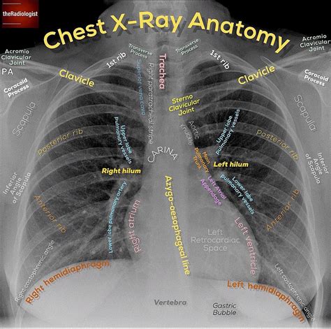 Image May Contain Text Medical Anatomy Radiology Medical Knowledge