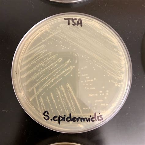 Staphylococcus Epidermidis Streak Plate