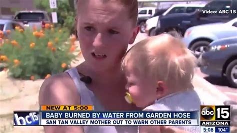 Mum's heatwave warning as baby suffers second degree burns from garden ...