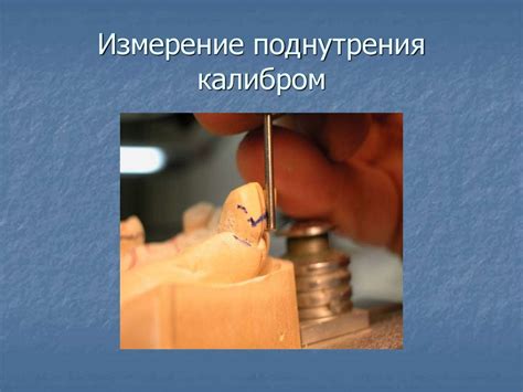 Нанесение границ каркаса бюгельного протеза презентация онлайн