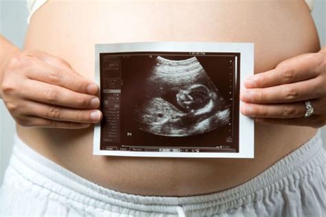 Ultrassons Gestacionais Conheça Os Tipos E Esclareça Suas Dúvidas