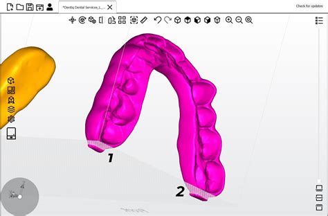 Polished Splints Direct From The 3d Printer
