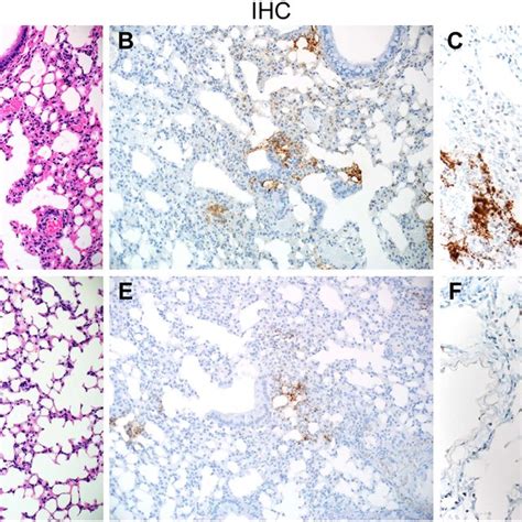 MERS CoV Viral Load In Tissues Collected From Jamaican Fruit Bats
