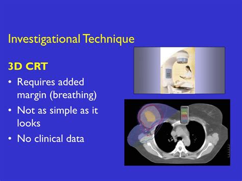 Ppt Current Practice In Partial Breast Irradiation Powerpoint
