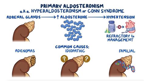 Primary Aldosteronism Hyperaldosteronism Video And Meaning Osmosis