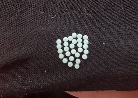 Can Someone Identify These Eggs Rinsects