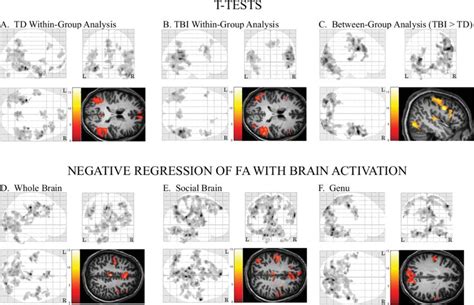 Three Plane Maximum Intensity Projections And Image Overlays For T Test Download Scientific