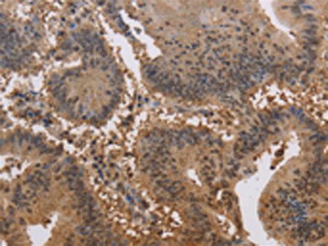 兔抗jag2多克隆抗体anti Jag2 Rabbit Polyclonal Antibody 生命科学产品与技术服务 生工生物工程上海