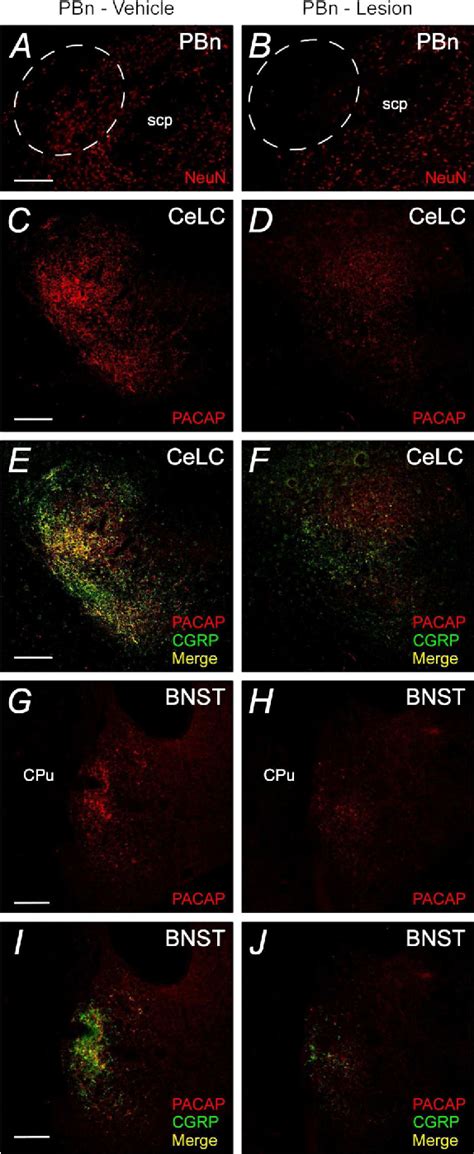 Lateral Parabrachial Nucleus Semantic Scholar