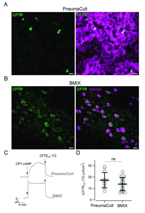 Effect Of Culture Medium On Cftr Expression Pattern Ab Detection Of
