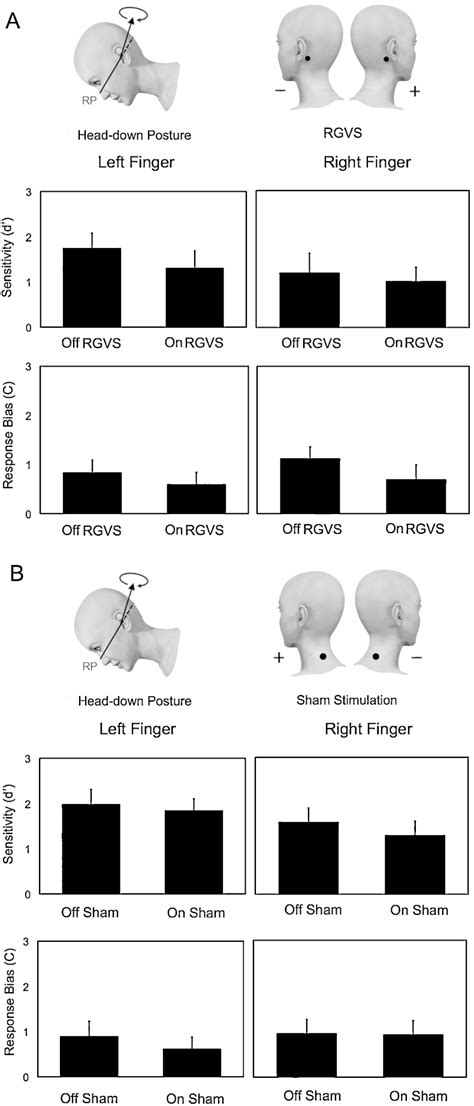 How The Vestibular System Interacts With Somatosensory Perception A Sham Controlled Study With