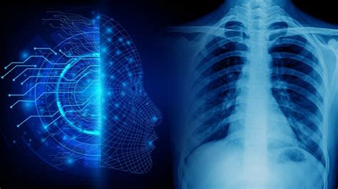 Based On Chest X Ray Data Ai Can Predict Long Term Mortality