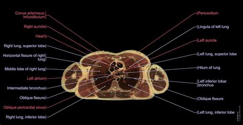 visible human project normal anatomy e anatomy