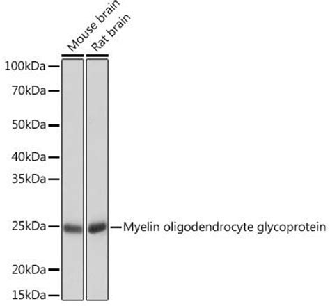 Anti Myelin Oligodendrocyte Glycoprotein 항체 Cab3992 Assay Genie