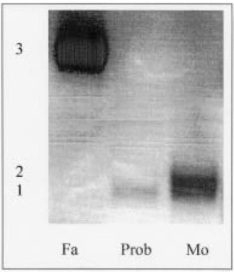 Dna Polymorphism Analysis By Polymerase Chain Reaction Pcr Download Scientific Diagram