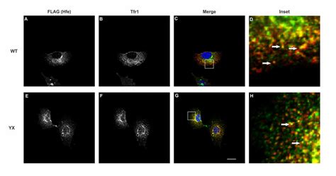 Co Localization Of Hfe And Tfr1 Confocal Analysis Was Performed To Download Scientific Diagram