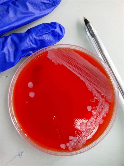 Hadi Feizi Posted On Linkedin