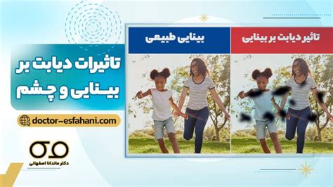 تاثیرات دیابت بر بینایی و چشم دکتر ماندانا اصفهانی