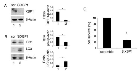 XBP1 Knock Down Promotes Autophagy And Impairs Cell Survival In PEL