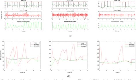 Figure 2 From Improving The Accuracy Of R Peak Detection In A Wearable