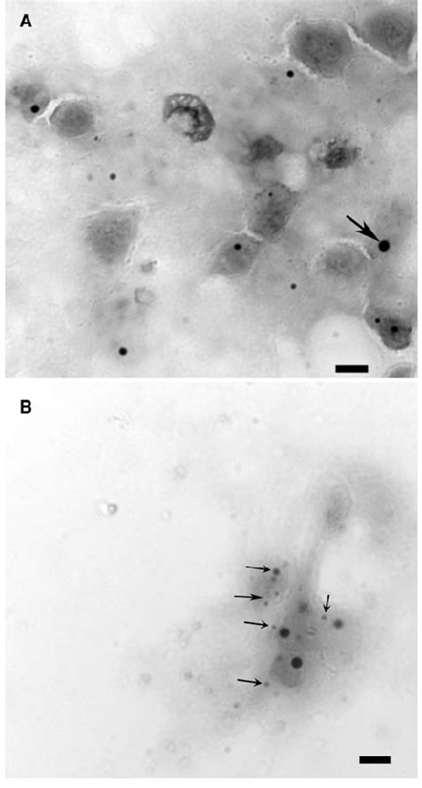 Amoebocytes