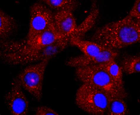 Complement C3 Antibody Ma5 32566