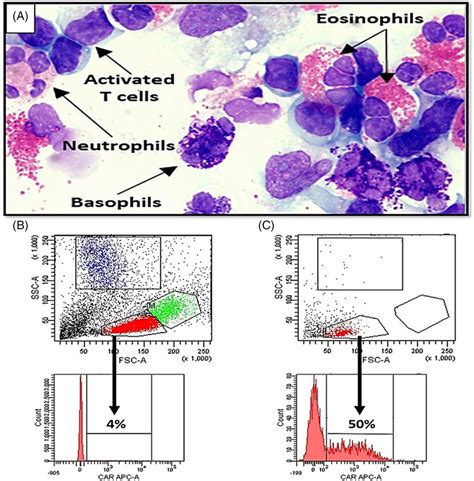 Comprehensive Csf Diagnostic Approach To Investigate Atypical Icans Download Scientific