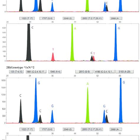 Representative Electropherogram Of Homozygous Patient With Genotype