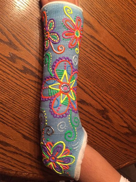 34 Best Fabulous Leg Casts Images On Pinterest Broken Leg Crutch And
