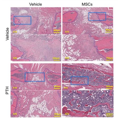 Rib Defect Surgery And Timeline After The Rat Had Been Anesthetized Download Scientific