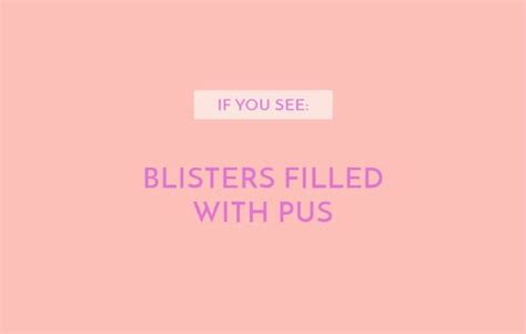 Bumps On Your Vagina And Other Vaginal Issues To Watch Out For Yourtango