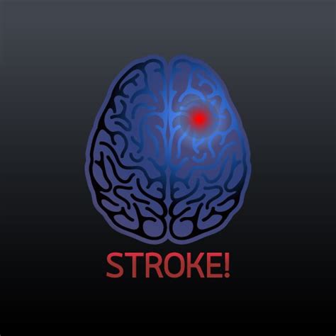 Brain Stroke Ishemic And Hemorrhagic Royalty Free Vector