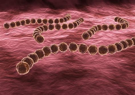 Scarlet Fever What Is Causes Symptoms And Treatment