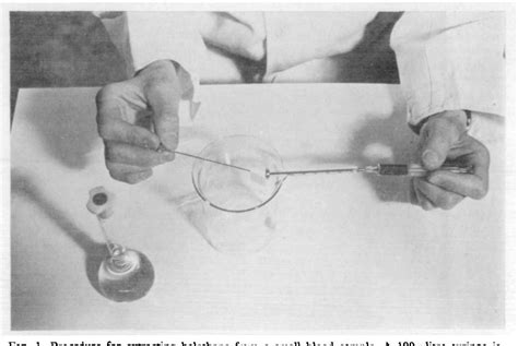 Figure 1 From A Method Of Gas Chromatography Using Electron Capture Detection For The