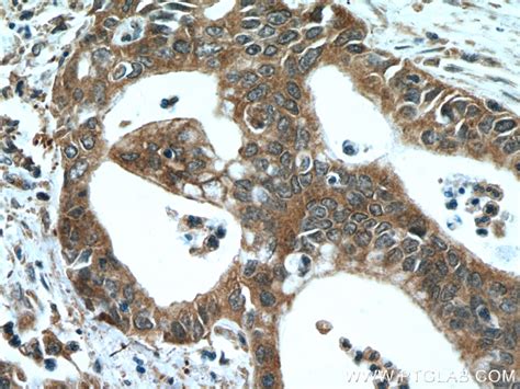 Neurod1 Antibody 66691 1 Ig Proteintech