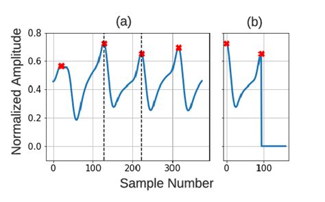 Ppg Signal With Preprocessing A Peak Detection B Converting One