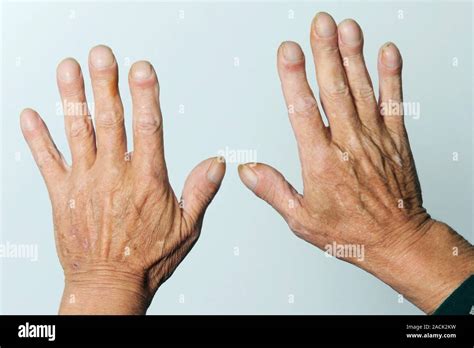 Not For Use In Television Not For Use In Television Hands Showing