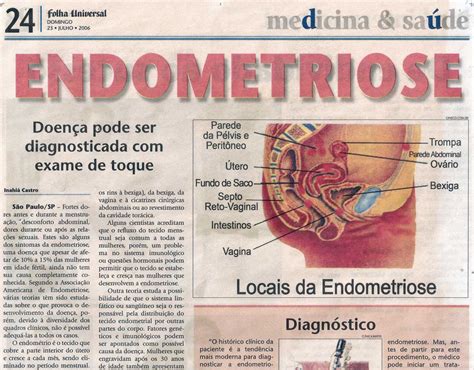 Endometriose Tabus Retratando Um Sonho