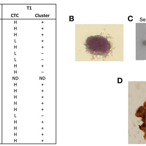 Ctc Isolation From Blood Samples Of Pdac Patients A After Isolation