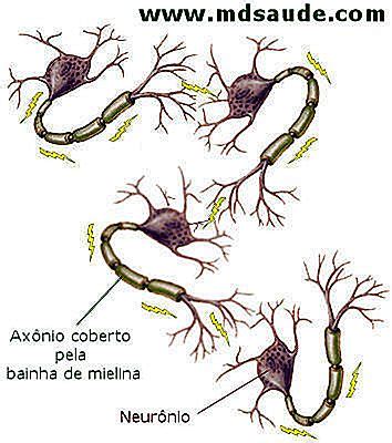 ESCLEROSIS MÚLTIPLE Síntomas y Tratamiento imevictoria
