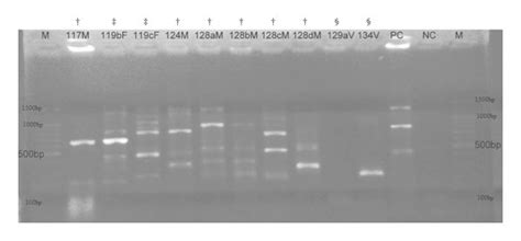 Representative Dna Fingerprints From Eric Pcr Of E Coli Isolates From