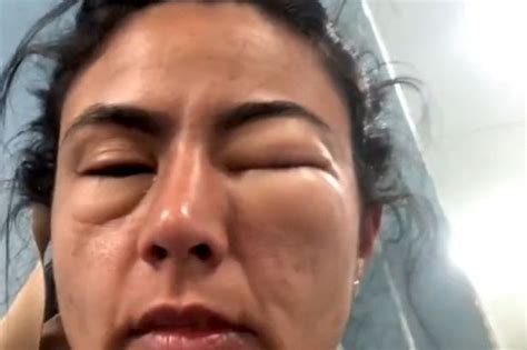 Woman Caught Performing Sex Act On Man In Hospital Faked A Fit To Avoid